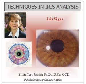 Iris Signs - Ellen Jensen
